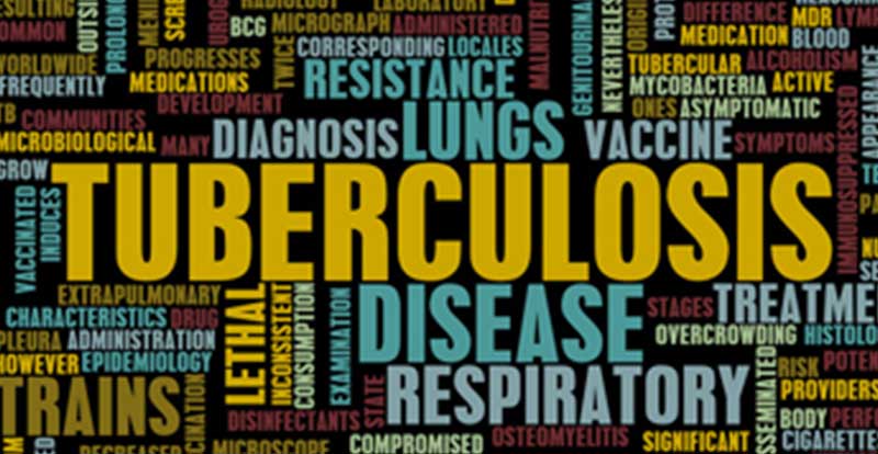 Tuberculosis in Children is Preventable and Curable